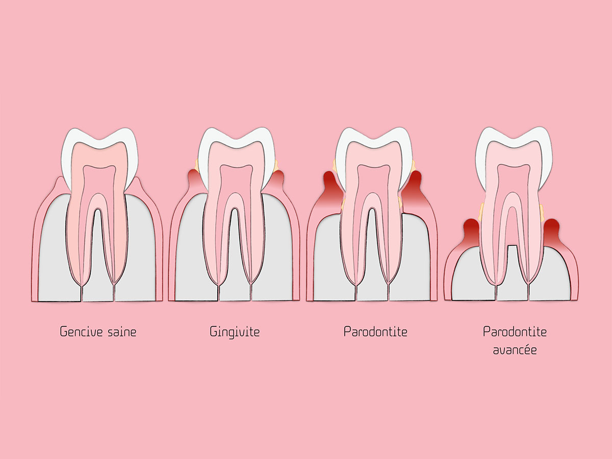 Periodontology practice in Lyon 3rd district: Smile again!